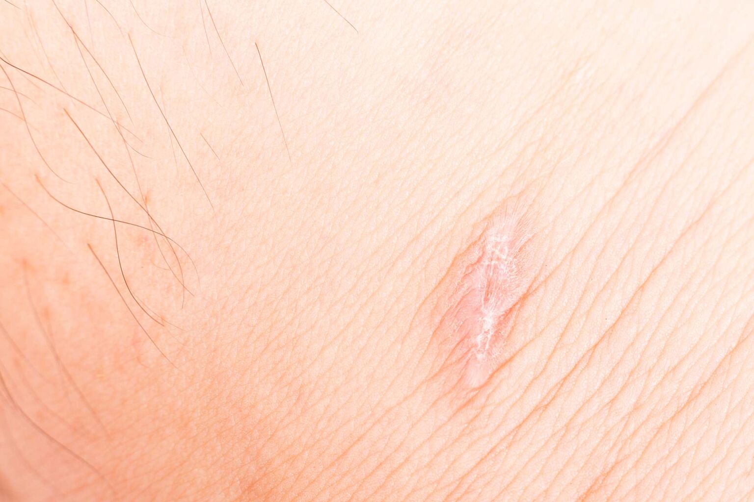 Homepage - Wound Doctor